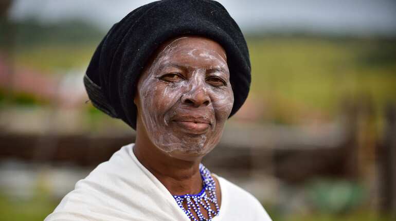 Skin bleaching in Africa: An 'addiction' with risks - World News