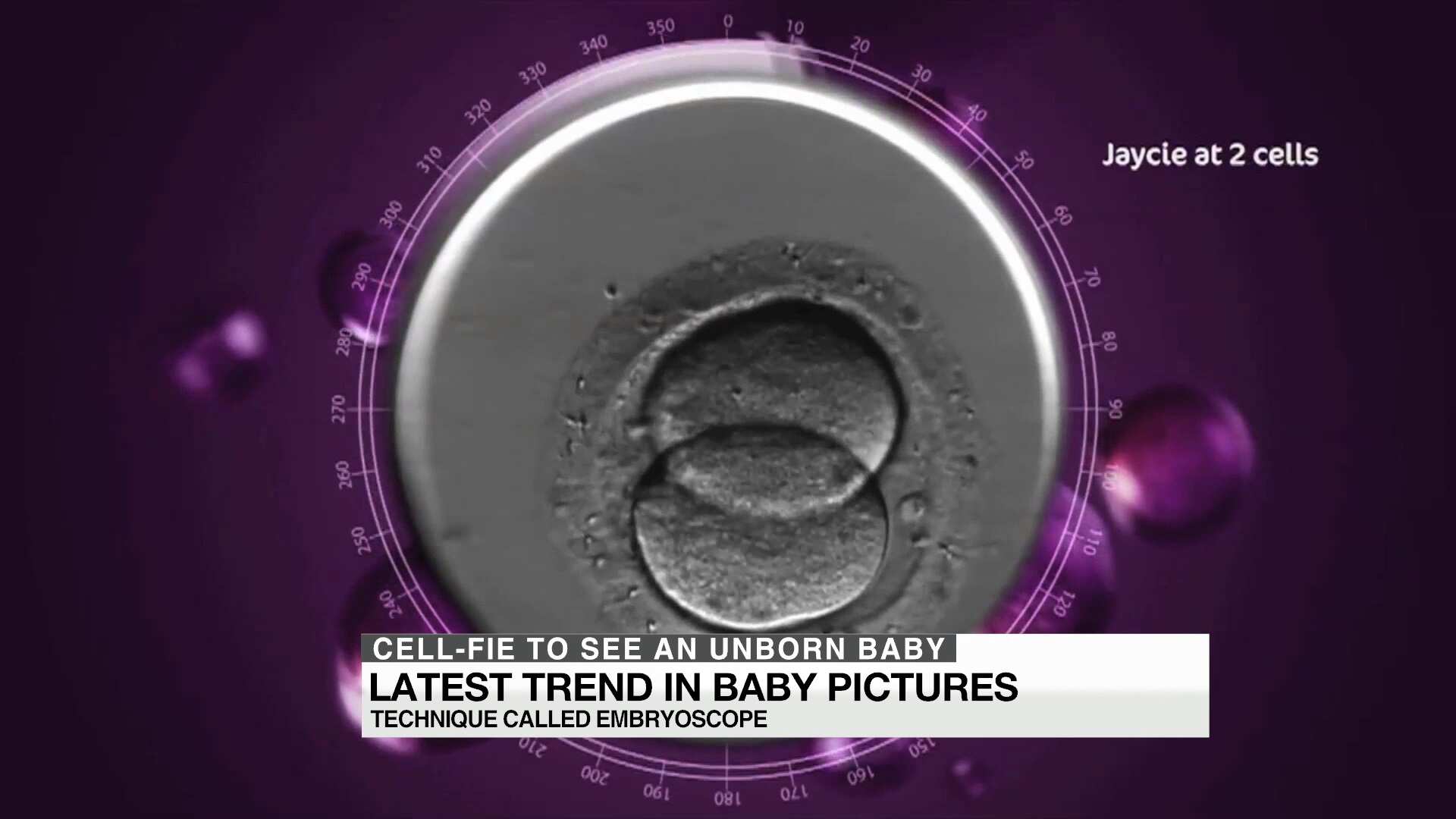 Cell-fie of your baby at embryo stage - World News