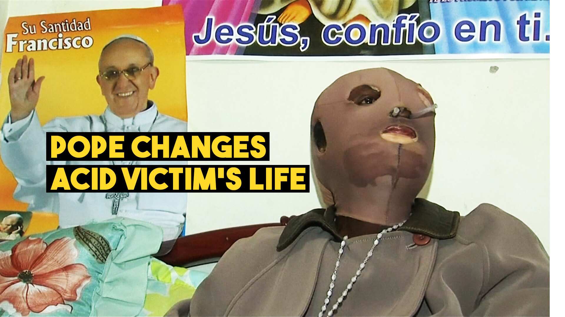 Acid burn victim finds new hope after meeting with Pope - Edge News
