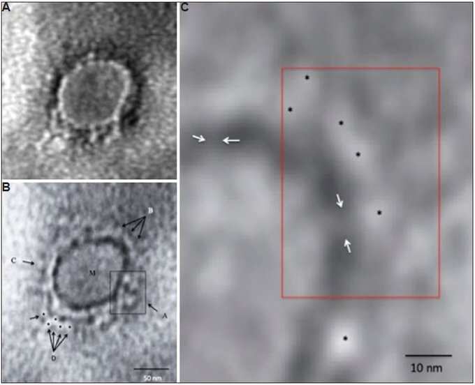 First electron microscope image of coronavirus from India released ...