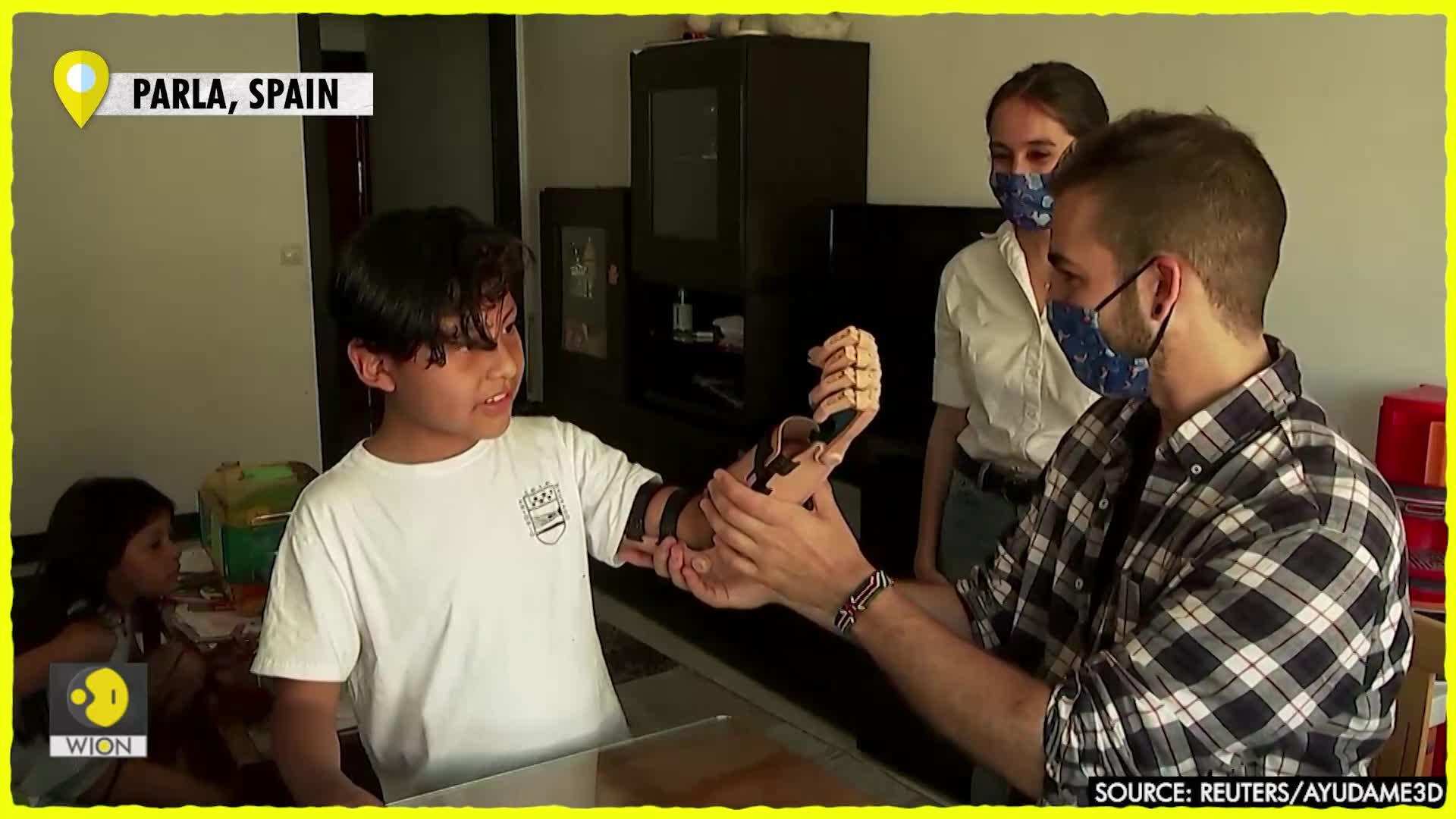 Meet the Spanish inventor who crafts 3D-printed, prosthetic arms - Edge ...