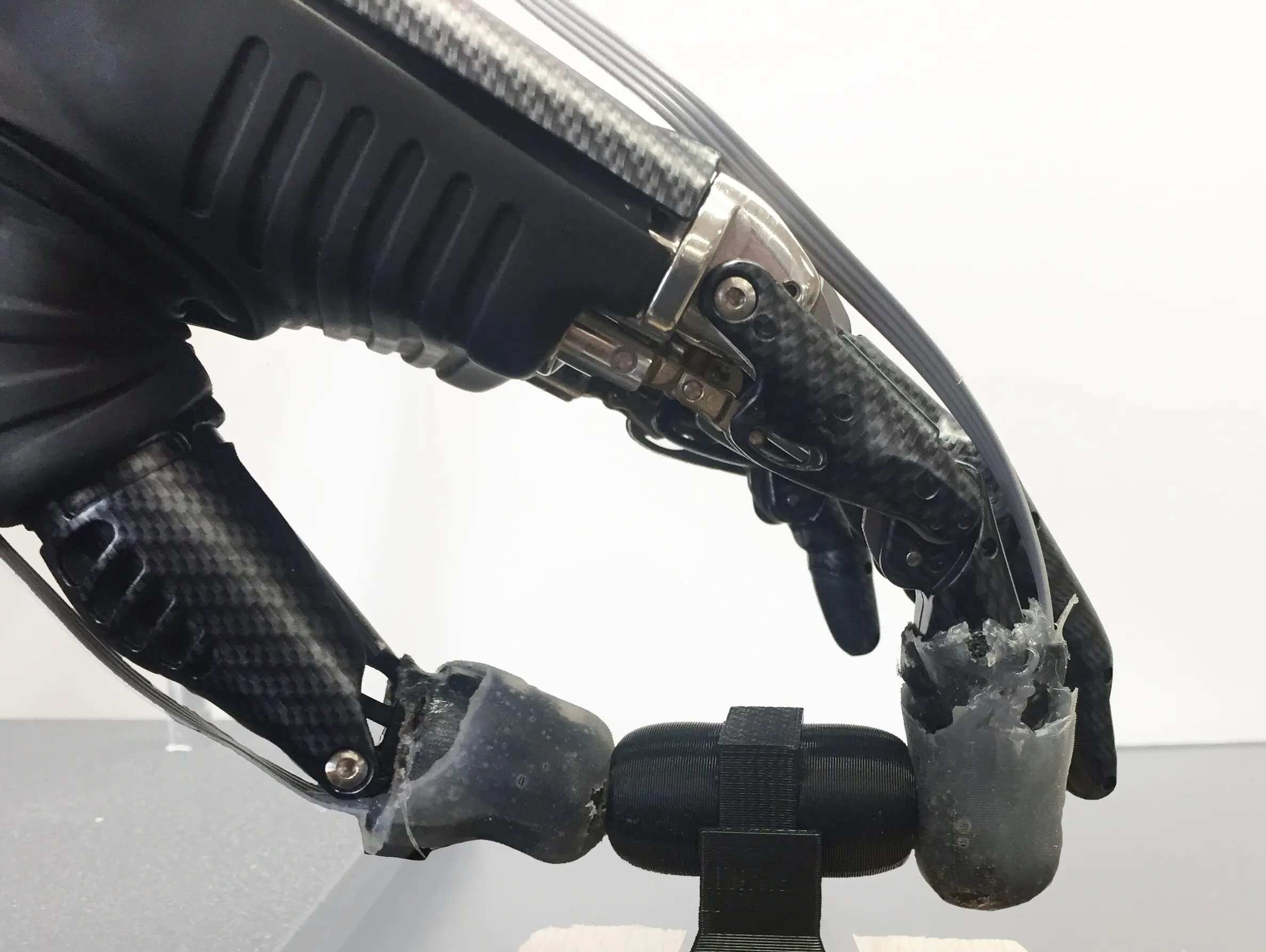 Low-cost Bionic arm transforms lives, helps attain basic mobility ...