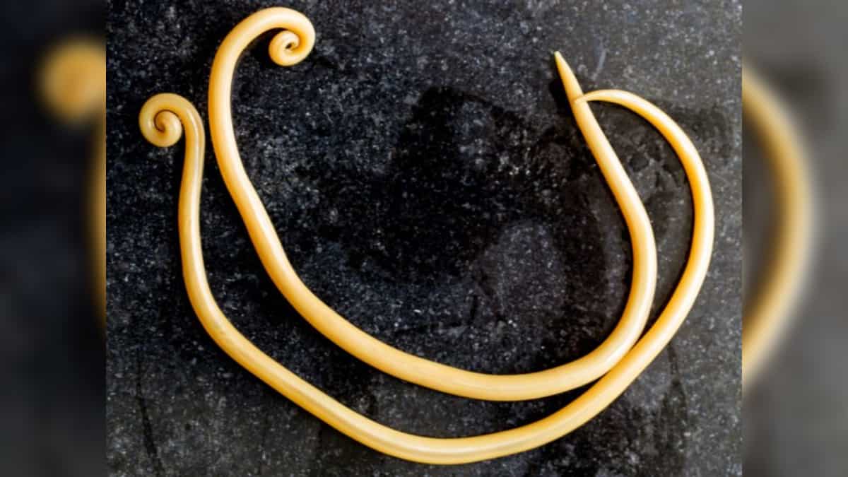 Four-year-old kid rushed to hospital after worm-infested food served at ...