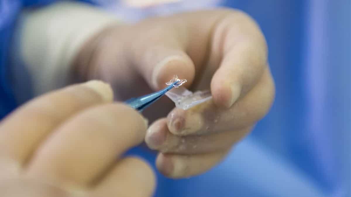 A first-of-its-kind procedure lets 83-year-old Italian man regain sight ...