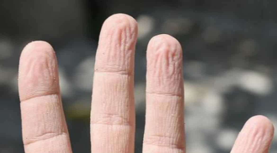 Wonder why fingers wrinkle under water? We finally have the answer to ...