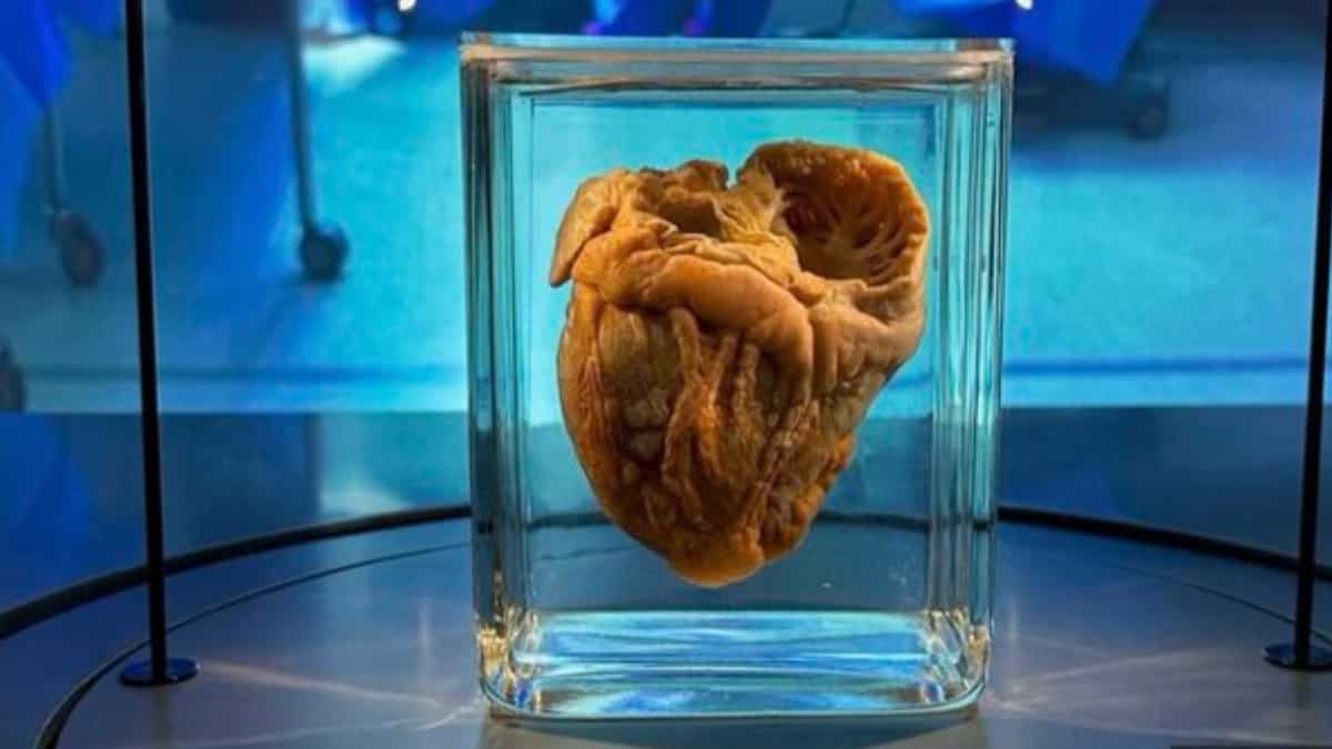 After 16 years, woman visits museum to see her own heart on display ...