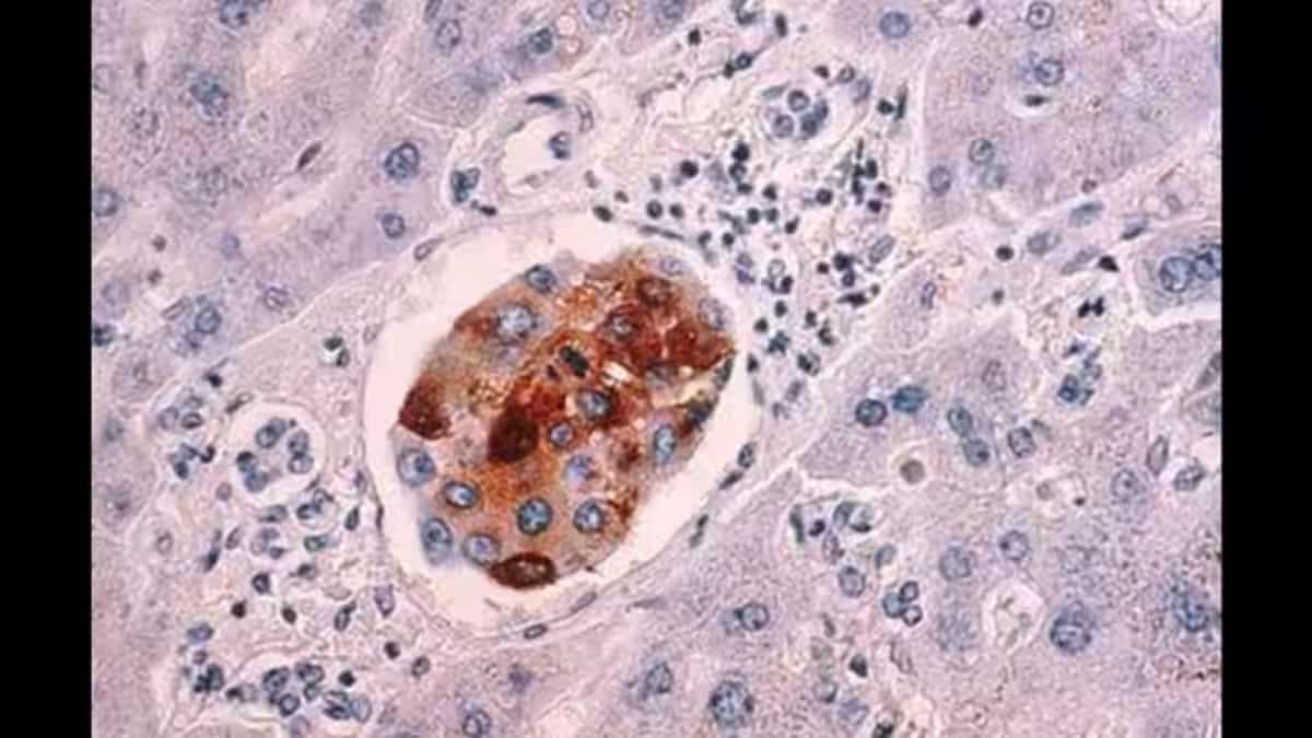 Scientists find key process in cell death that stops progression of ...