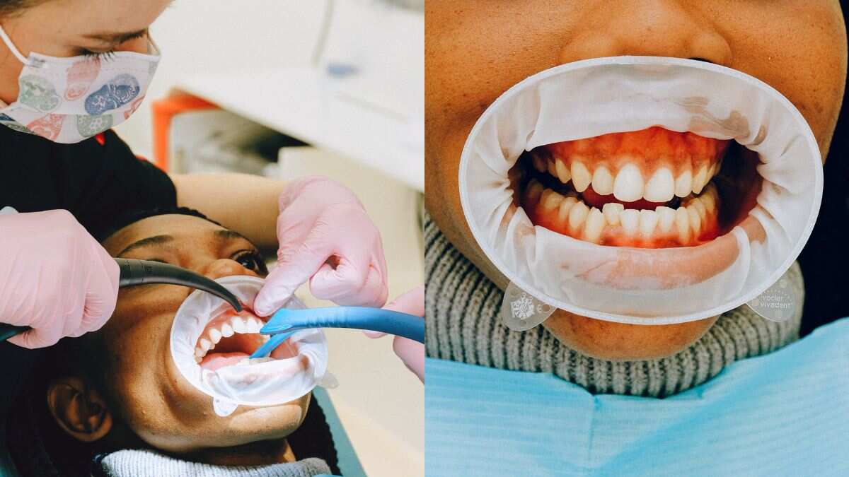 5 most neglected dental conditions and how they can be corrected with ...