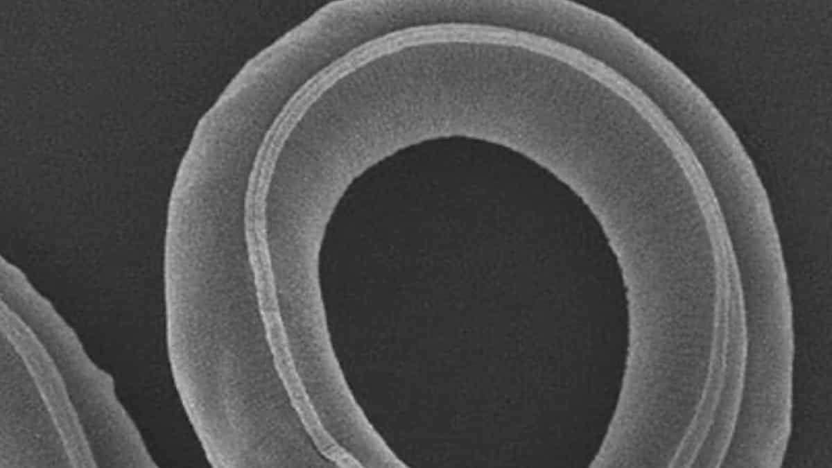 Scientists revive worm frozen for 46,000 years in Siberian permafrost ...