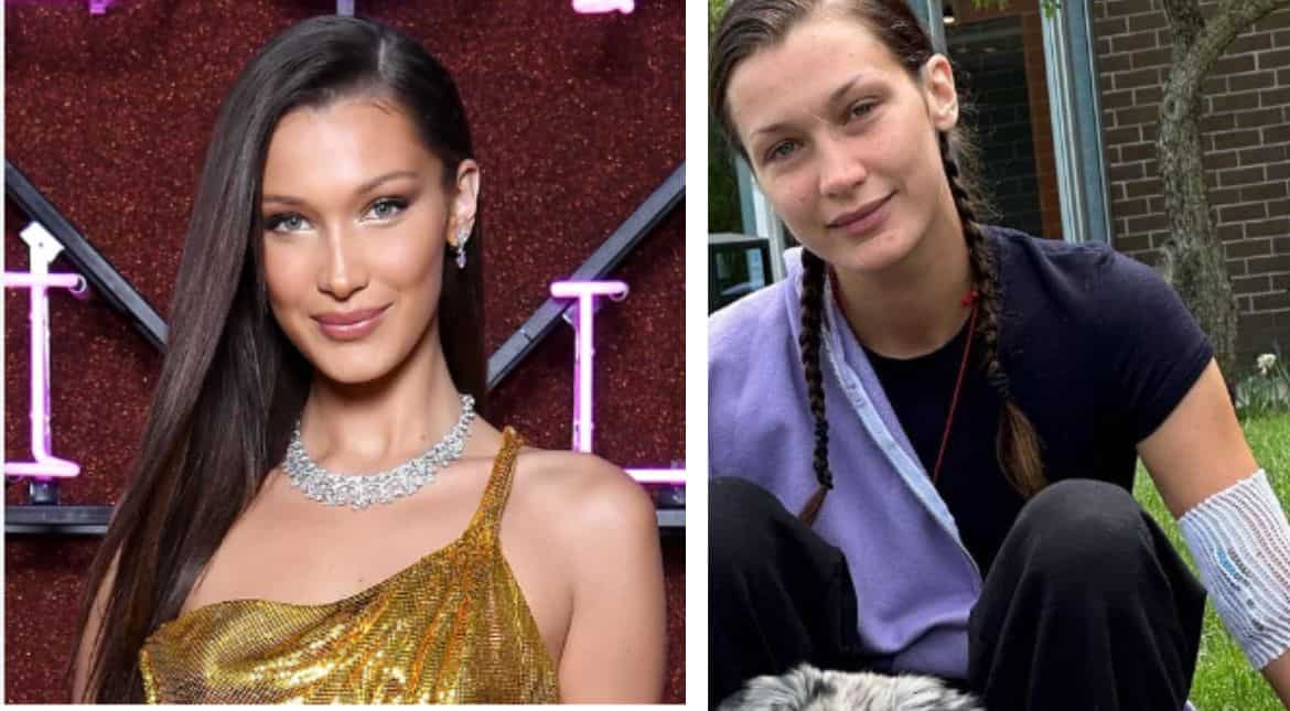 Bella Hadid details her struggle with Lyme disease after battling it ...