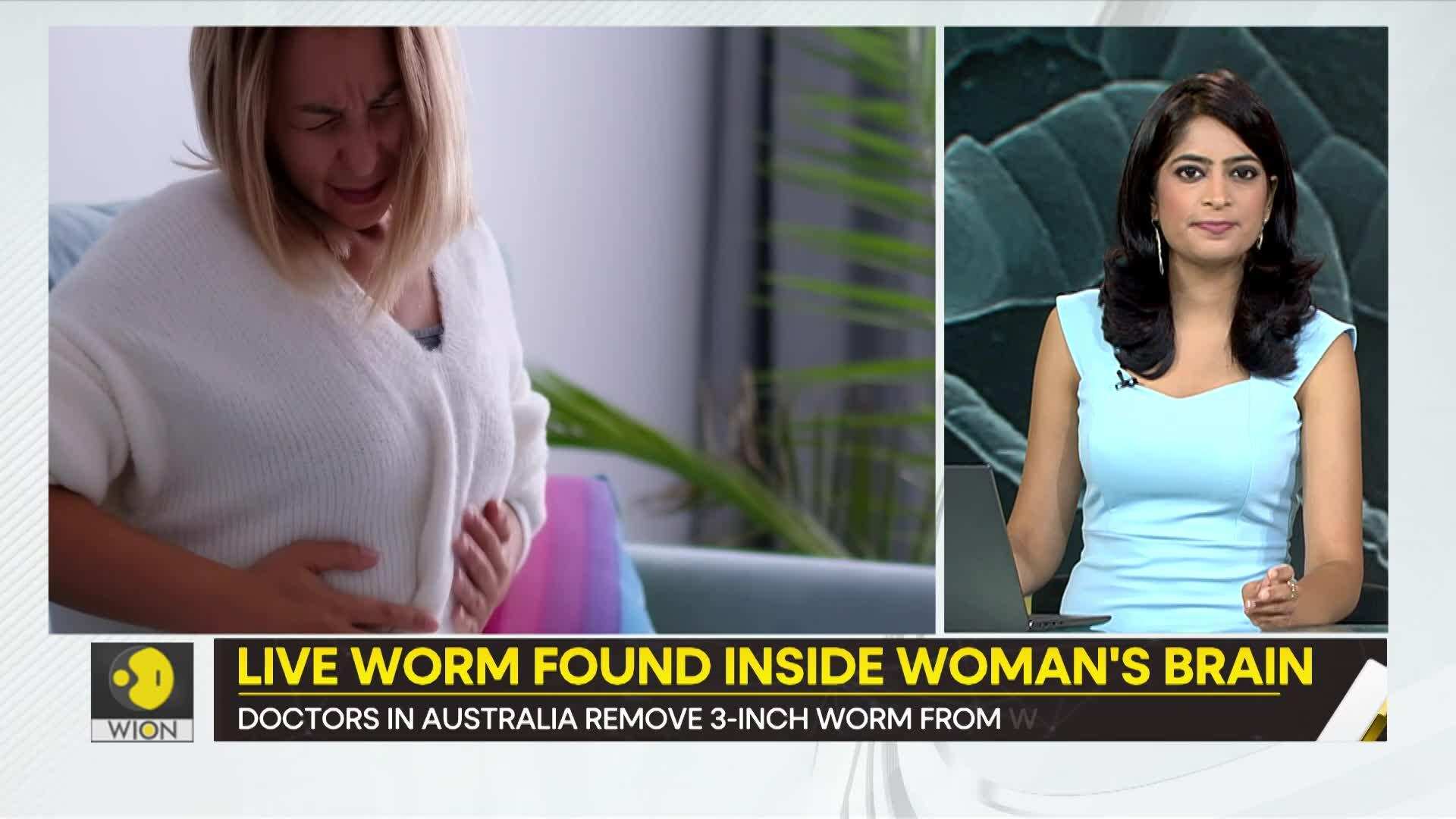 Gravitas : Brain Worm Nightmare: Doctors Pull Live Parasite from ...