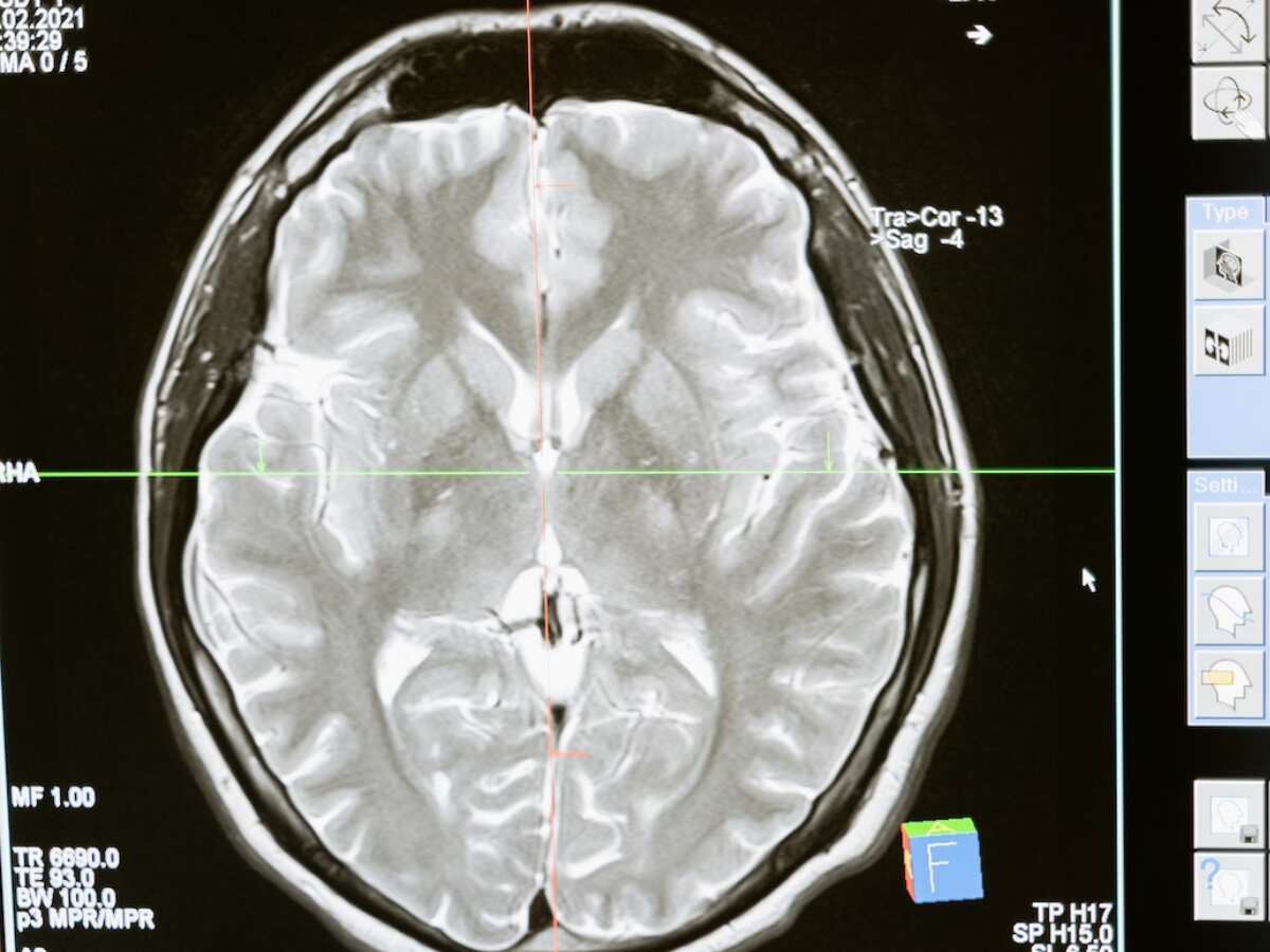 Origins of brain cells found in 800 million-year-old creatures ...