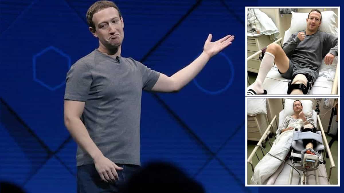 Mark Zuckerberg undergoes surgery for torn knee ligament repair, shares ...