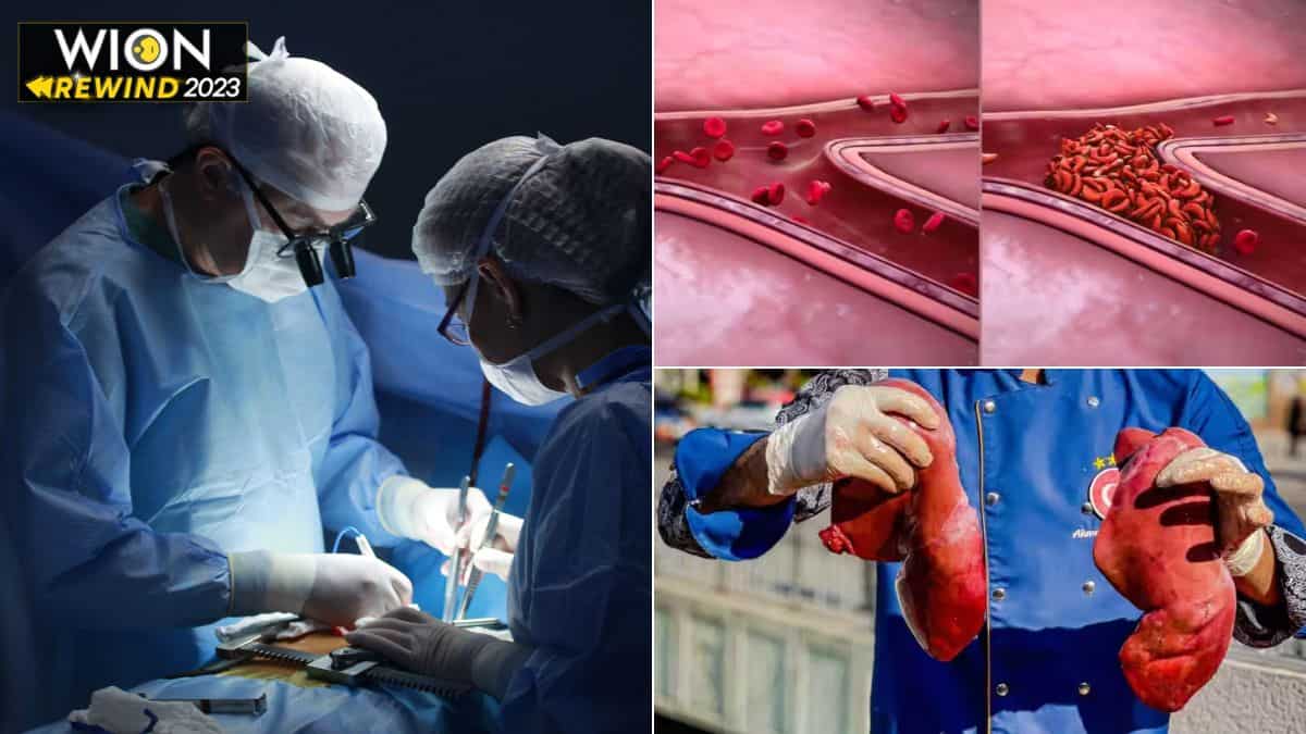Explained | Let's 'Rewind 2023' to medical breakthroughs that gave the ...