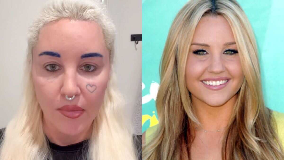 Amanda Bynes opens up about eyelid surgery; calling it 'the best ...