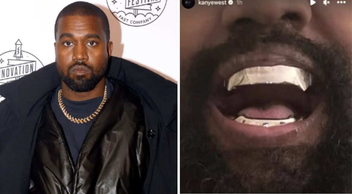 Kanye West shocks fans as he gets $850,000 titanium teeth - Trending News