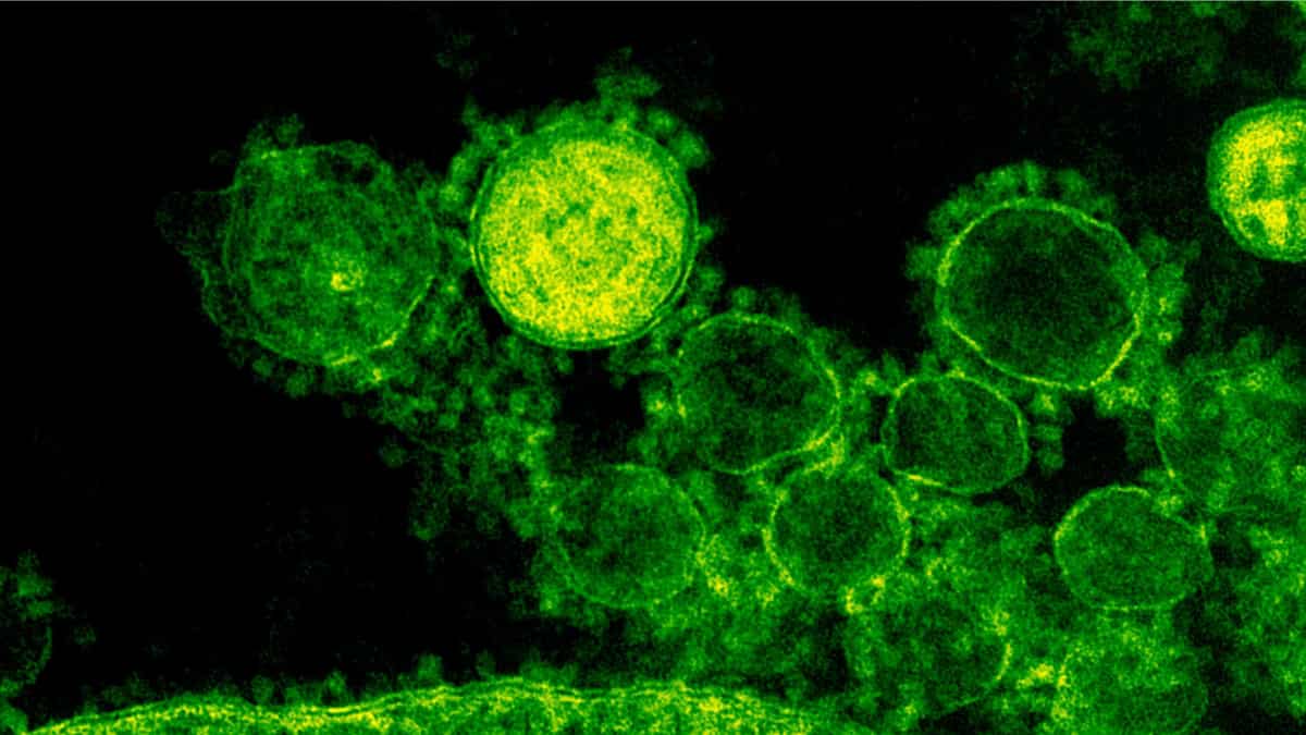 What is Alaskapox? The newly-found viral disease that has already ...