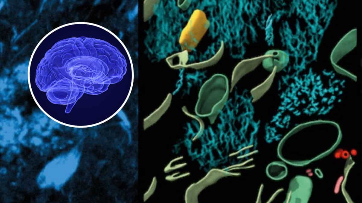 A deep look inside Alzheimer's brain: Molecule structure of proteins ...