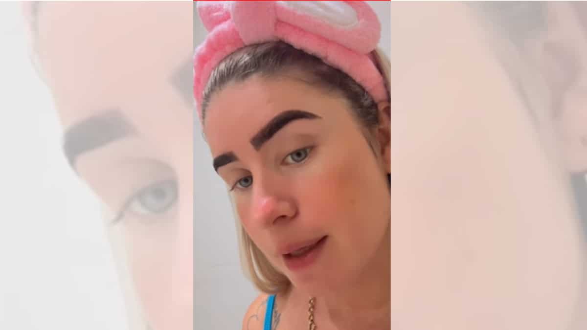 GROSS! Brazilian model uses poop for skincare; DON'T DO IT, say doctors ...