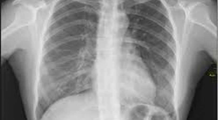 International X-Ray day: How Rontgen discovered the 'unknown' rays ...