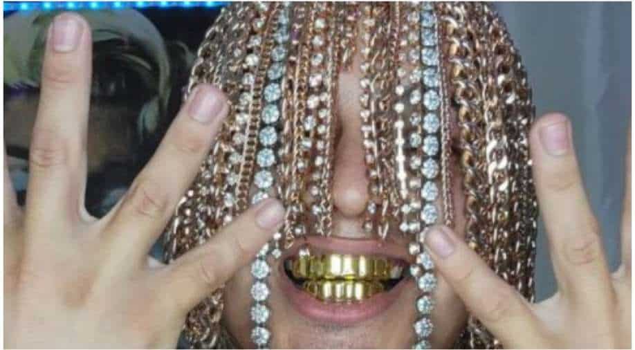 Rapper replaces his hair with gold chains through surgery ...