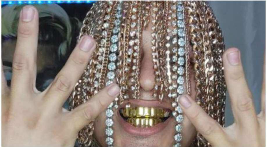 Rapper replaces his hair with gold chains through surgery ...