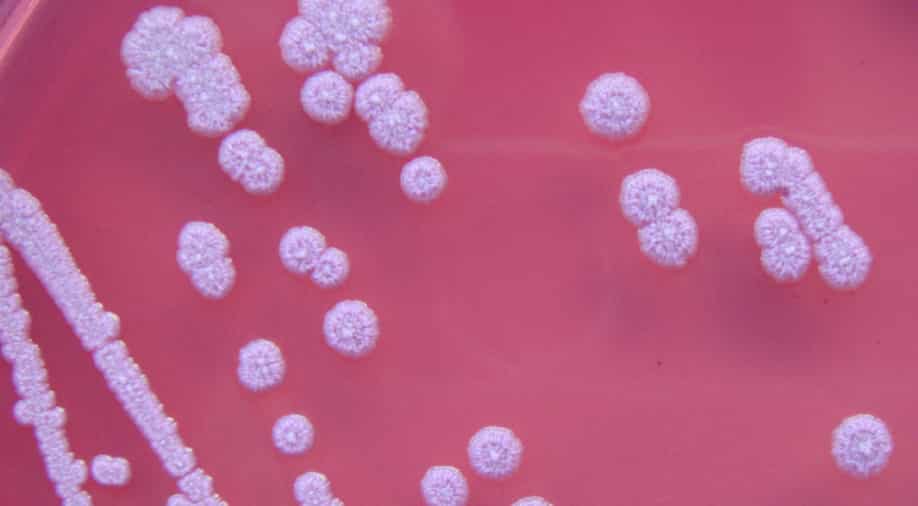 Bacteria behind rare disease found in United States for first time ever ...