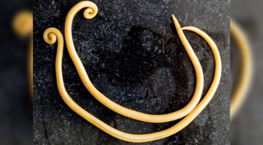 Four-year-old kid rushed to hospital after worm-infested food served at ...