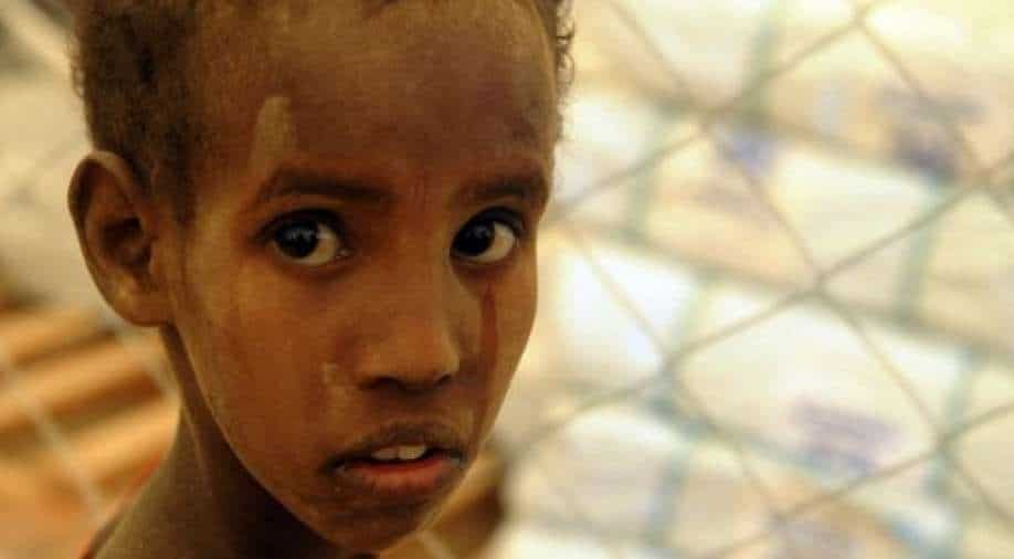 22 million face starvation in Horn of Africa: World Food Programme ...