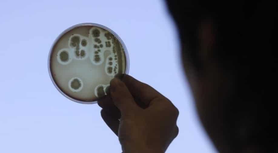 Bacterial infections killed nearly eight million people, second-leading ...