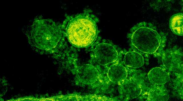 What is Alaskapox? The newly-found viral disease that has already ...